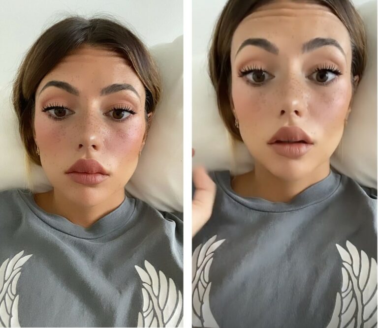 Social Media Filters: A Cause of Body Dysmorphia or Just A Form of ...